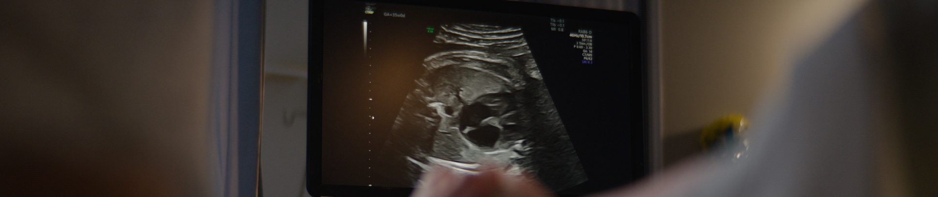 Monitor movements - Still Six Lives